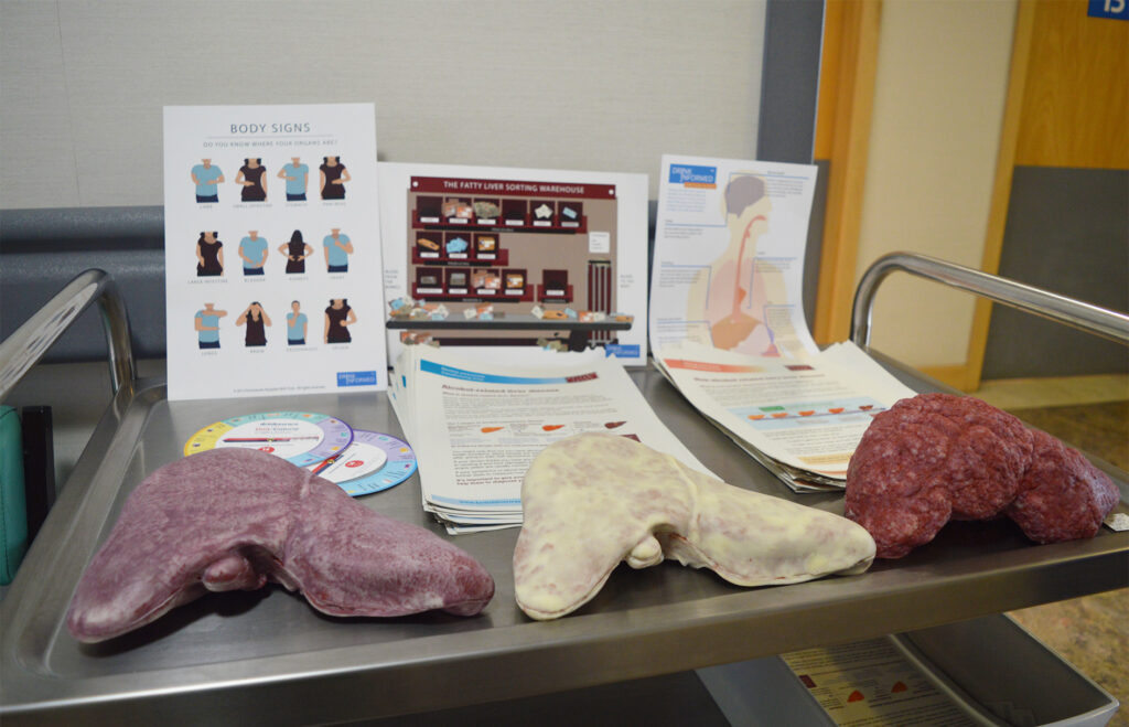 Local hospitals support Love Your Liver Month with free community and ...